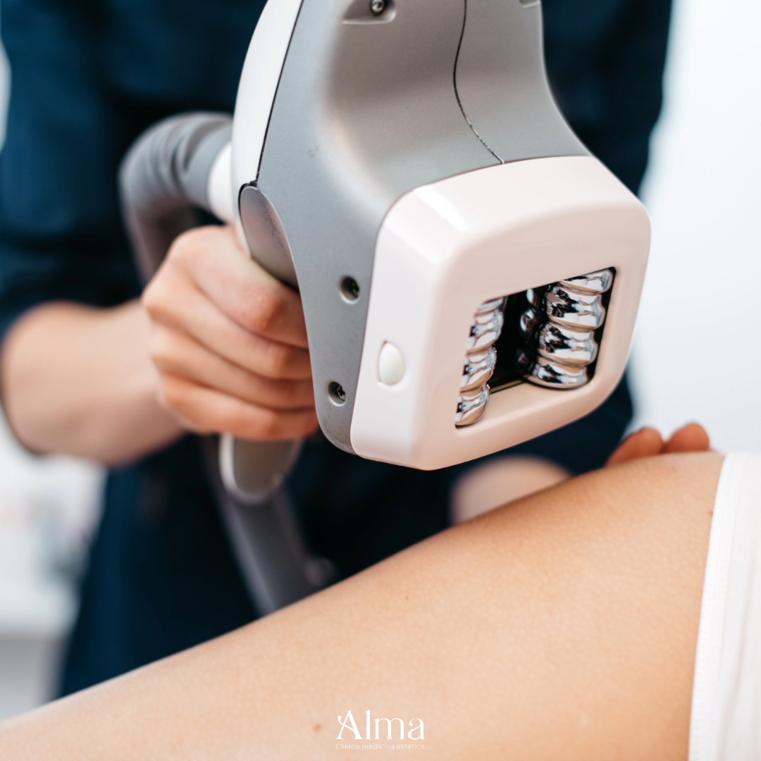 Modelado corporal: Velashape – Clínica Medicina Estética Alma